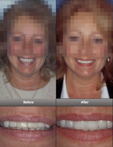 Bridgework | Professor Paul Tipton